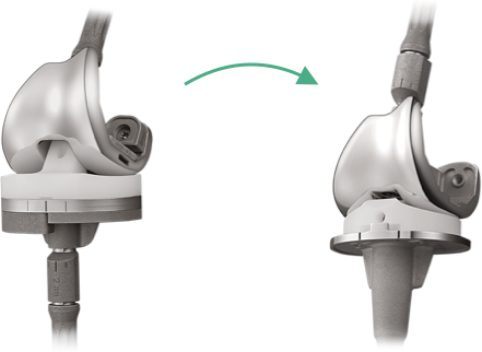 USTAR II | Products | Knee | United Orthopedic Corporation Switzerland